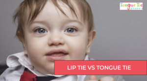 Exercises for Tongue Tie Without Surgery [5 Practices to Fix]