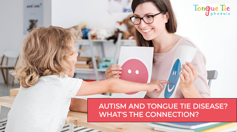 Tongue Tie Test: Signs, Diagnosis, and 7 Steps for Assessment