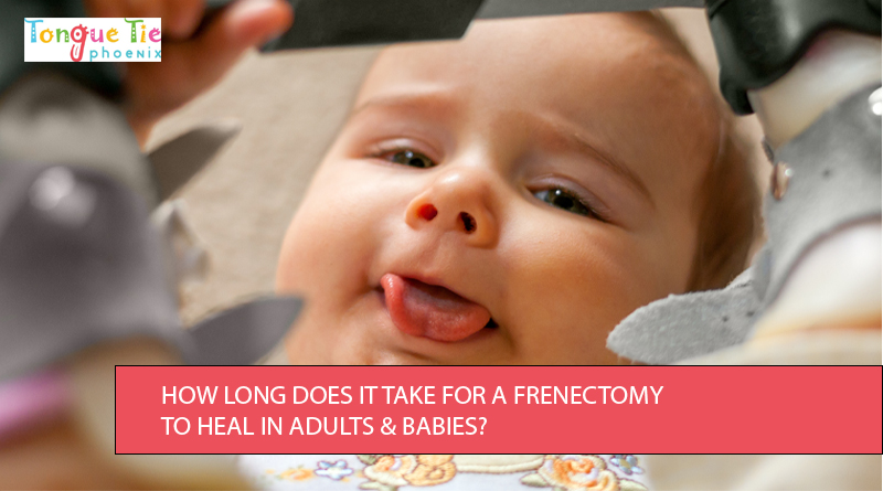How Long Does It Take for a Frenectomy to Heal? 5 Recovery Tips